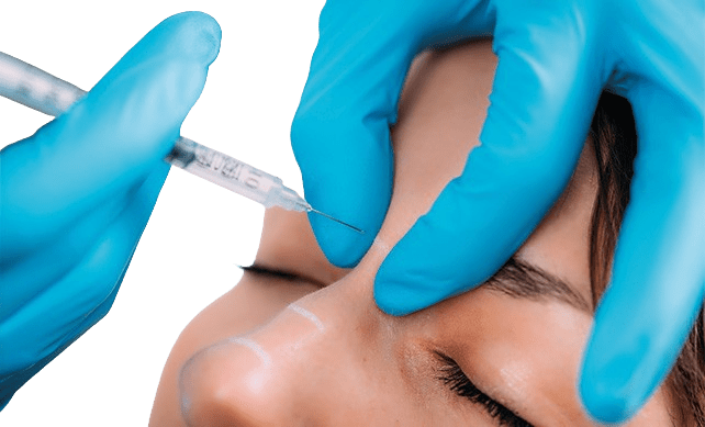 Rinomodelación Con Filler #1 Tratamiento Seguro Y Eficaz Para Vos!